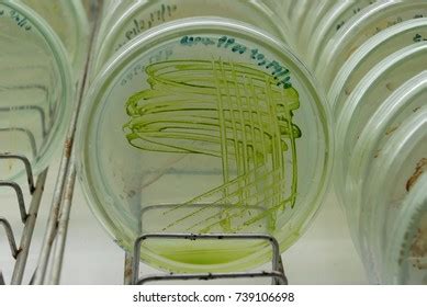 Pure Culture Green Microalgae Grows On Stock Photo Shutterstock