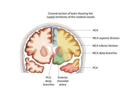 Stroke Localization Pptx