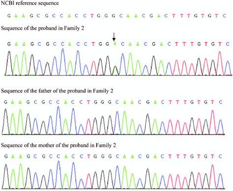 Sequencing Results Of The C4925 Ga Heterozygous Mutation In The Tsc2