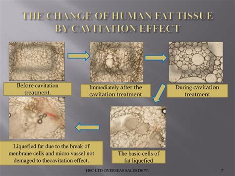 Ppt What Is Cavitation Powerpoint Presentation Free Download Id 2330047