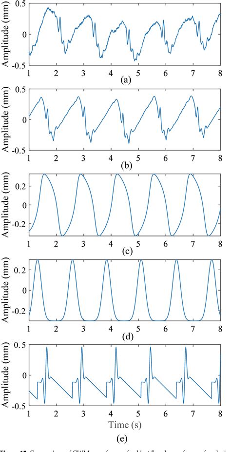 Figure 15 From Chest Wall Motion Model Of Cardiac Activity For Radar Based Vital Sign Detection