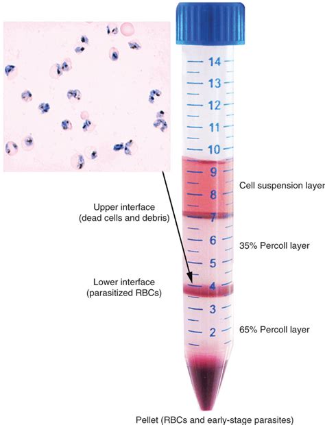 Purification Of Parasitized Rbcs On A Percoll Step Gradient Consisting Download Scientific