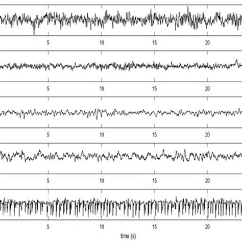 Plot Of The First Signal In Each EEG Set Set A E From Top To Bottom