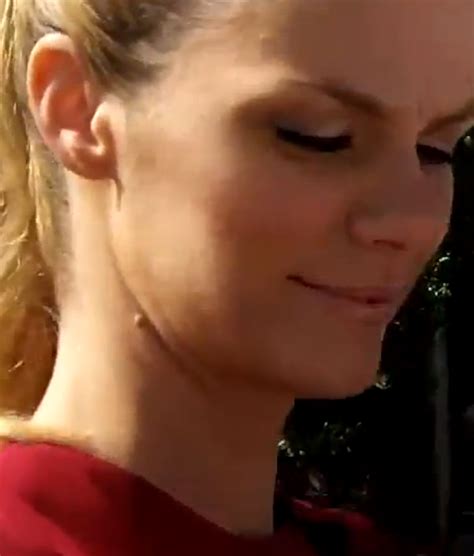 Brooklyn Decker Neck Mole 3