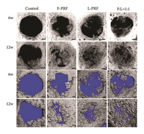 Bone Regeneration In Rabbit Critical Size Calvarial Defects And Download Scientific Diagram