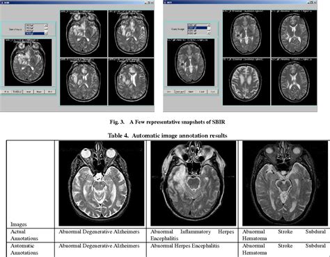 Table 4 From Automated Image Annotation For Semantic Indexing And Retrieval Of Medical Images