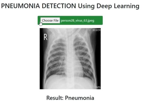Tariq Ahmad On Linkedin Deeplearning Aiinhealthcare Computervision Tensorflow