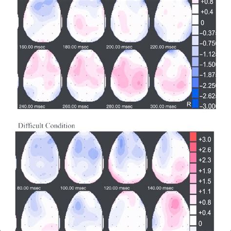 a statistical parametric maps of activation p