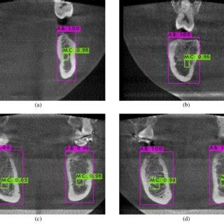 Examples Of Detection Results Download Scientific Diagram