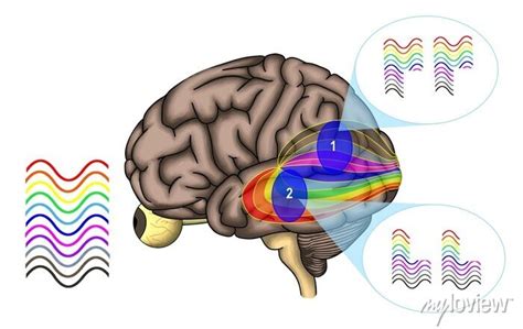 The Patterns Of Visual Field Defect According To The The Difference Cartazes Para A Parede