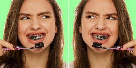 7 Best Charcoal Toothpastes For A Pearly White Smile Yourtango