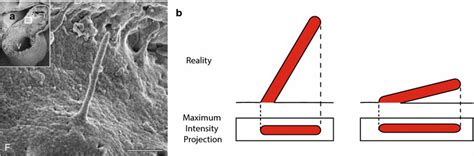 Visual Appearance Of A Primary Cilium A Scanning Electron Microscopy Download Scientific