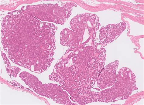 Oral Tissues Clinical Tree