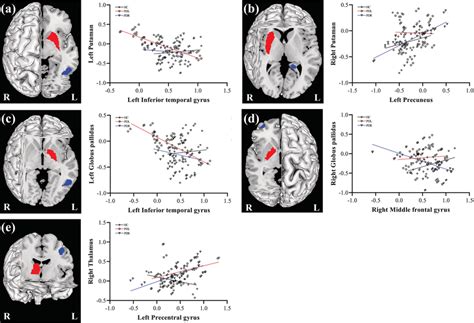 Group Differences In The CBFconnectivity Within BA Subregions The Download Scientific Diagram