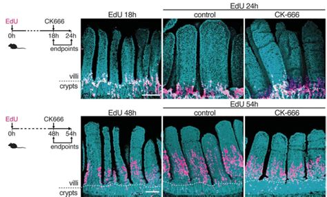 《科学》：这么多年又白学了！科学家首次发现，肠上皮细胞竟然长了孔武有力的「脚」，能自主迁移，顶替死去的细胞兄弟丨科学大发现 搜狐大视野 搜狐新闻