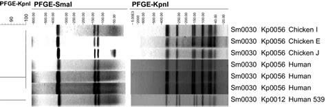 Clonal Relationships Between Campylobacter Jejuni Human Isolates And