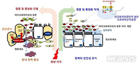 염증성 장질환·대장암 등 염증 완화 실마리 찾았다
