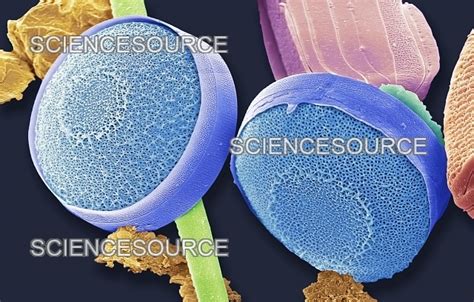 Diatoms Scanning Electron Micrograph Stock Image Science Source Images