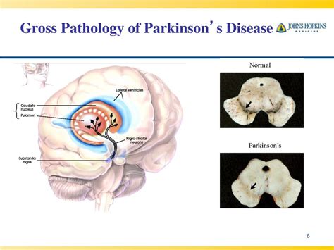 Ppt Disclosures Powerpoint Presentation Free Download Id246780