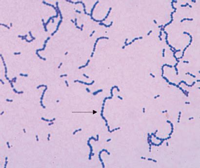 Streptococcus Gram Stain