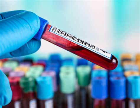 Ptt Be Indicative Of A Prothrombotic State Vetemcrit