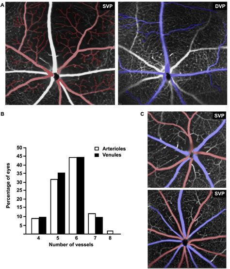 Structure Of Hyaloid Artery Semantic Scholar