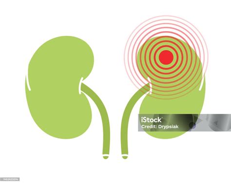 인간의 신장 통증 기호입니다 신장 통증 아이콘입니다 벡터 그림입니다 인체 통증 통증 점 보살핌에 대한 스톡 벡터 아트 및 기타 이미지 Istock