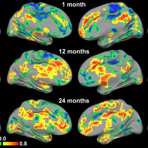 relationships between intersubject variability of the brain s