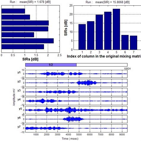 performance analysis of extracted pcg signal and sir value for overall