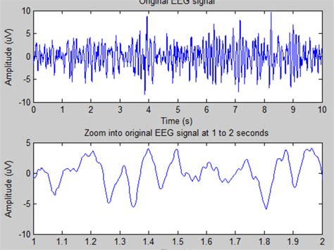 Real Time Eeg Signal Analysis Using Matlab Simulink Upwork