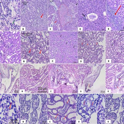 Gene Expression Level Of Tnf ɑ Gene In Urinary Bladder Tissues Of Download Scientific Diagram