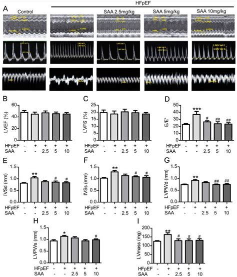 Heart Failure With Preserved Ejection Fraction Hfpef Model Creative
