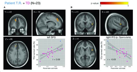 Correlations Of Functional Mri Fmri Activation Temporal Order
