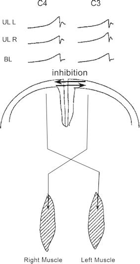 Interhemispheric Inhibition And Corresponding Movement Related Cortical Download Scientific