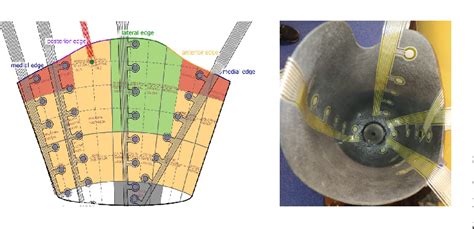 Figure 1 From Wearable Pressure Sensing For Lower Limb Amputees Semantic Scholar
