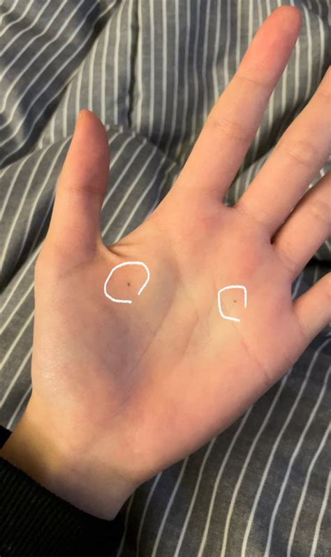 손바닥 점 관상 지식in