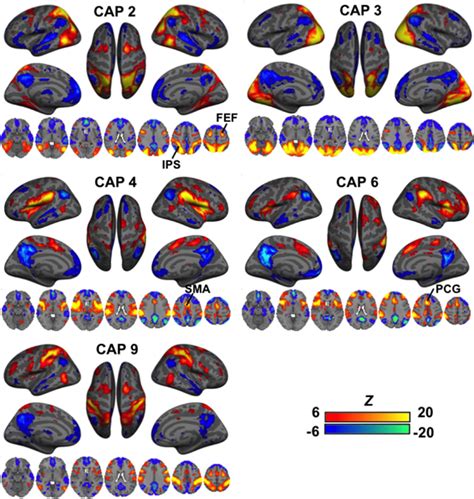 Frontiers Decomposition Of Spontaneous Brain Activity Into Distinct