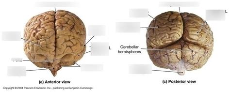 Anteriorposterior Brain Diagram Quizlet