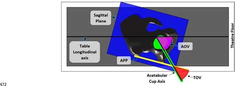 Pdf Operative And Radiographic Acetabular Component Orientation In