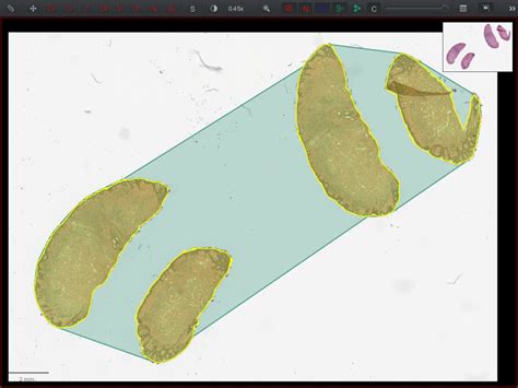 Qupath Script Command To Draw Polygon Annotation From Points Image Analysis Imagesc Forum
