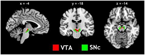 Substantia Nigra And Ventral Tegmental Area