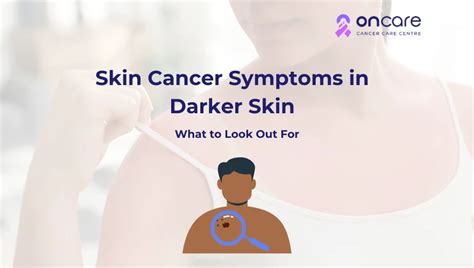 Stage 1 Skin Cancer Symptoms Treatment Recovery And Survival