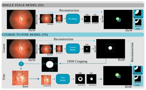 Assessing Coarse To Fine Deep Learning Models For Optic Disc And Cup