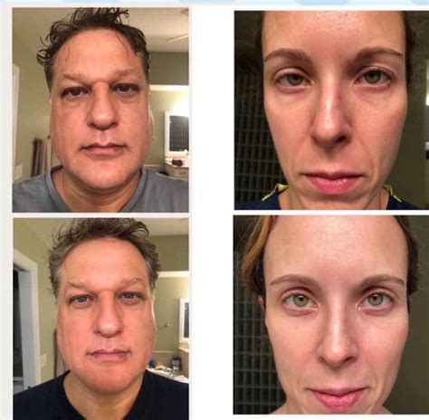 Deborah Thibodeau On Linkedin Check Out Husband And Wife Miguel And Alissa‘s Results They Are