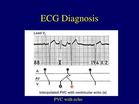 Ppt Dsp 概論 Biomedical Signal Processing Powerpoint Presentation