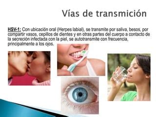 Herpes Pptx