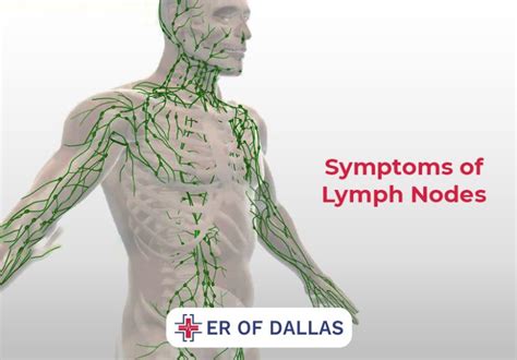 Lymph Nodes Symptoms Causes Types And More Er Of Dallas Tx
