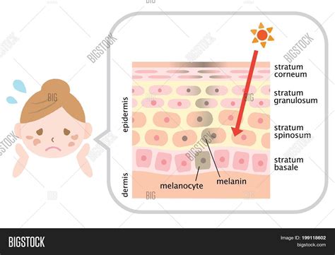 Infographic Skin Image And Photo Free Trial Bigstock
