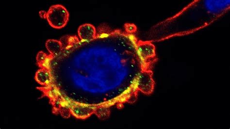 New Study Suggests Promising Approach For Treating Pancreatic Cancer