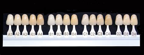 Choosing The Right Shade A Guide To Picking Your Tooth Color